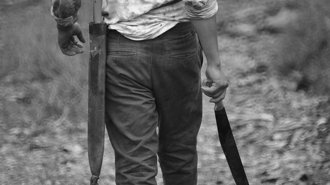 Le cortaron la mano derecha con un machete por ladrón | Minuto30