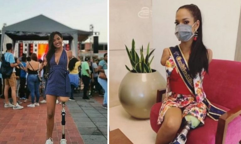 Modelo sin brazos ni pierna compite en Miss Ecuador