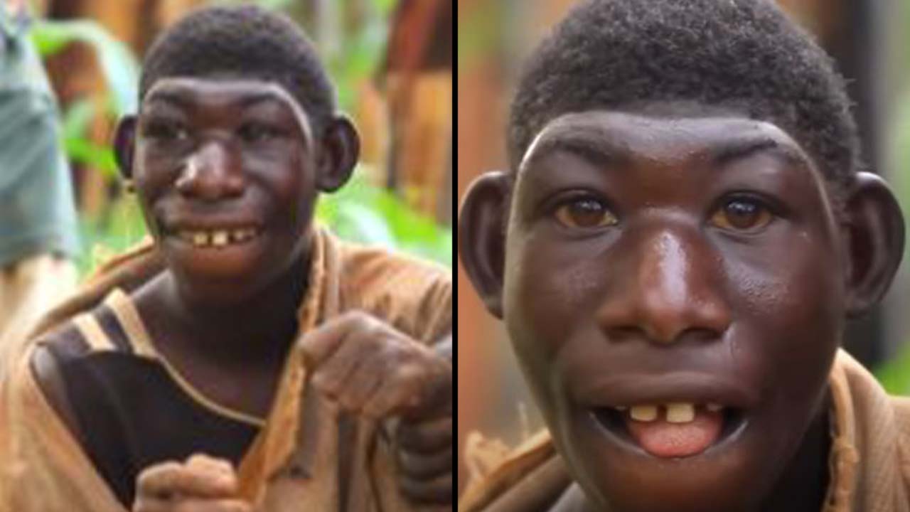 Video. Le hacían bullying por su apariencia de “Mono”, pero ahora es famoso