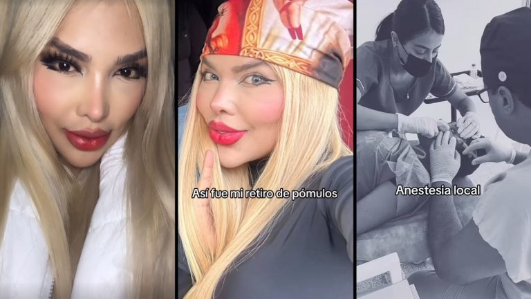 ¡Impactante VIDEO! Barbie colombiana mostró cómo fue el retiro de sus ...