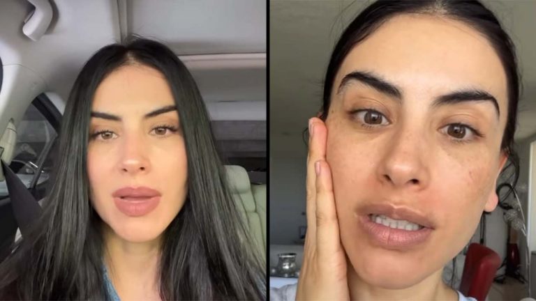 VIDEO. No se alarmen por las manchas, así es la piel de Jessica Cediel ...