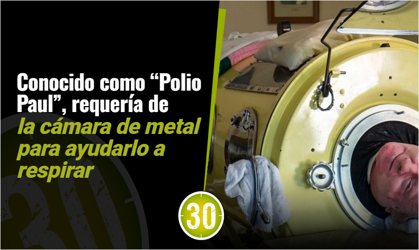 Muere Paul Alexander, vivió 70 años con un 'pulmón de acero'