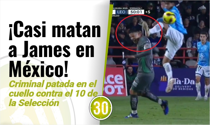 ¡Casi matan a James en México! Criminal patada en el cuello para el 10 ...